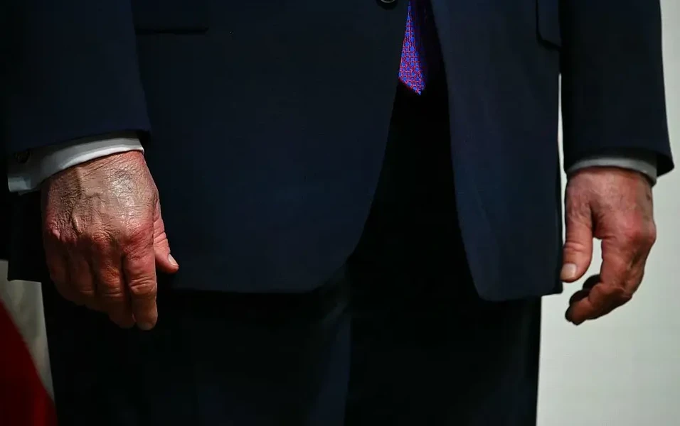 Poll shows steep drop in public confidence in Trump's health