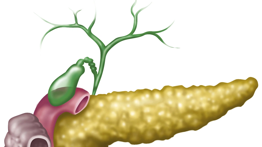 12 early warning signs of pancreatic cancer