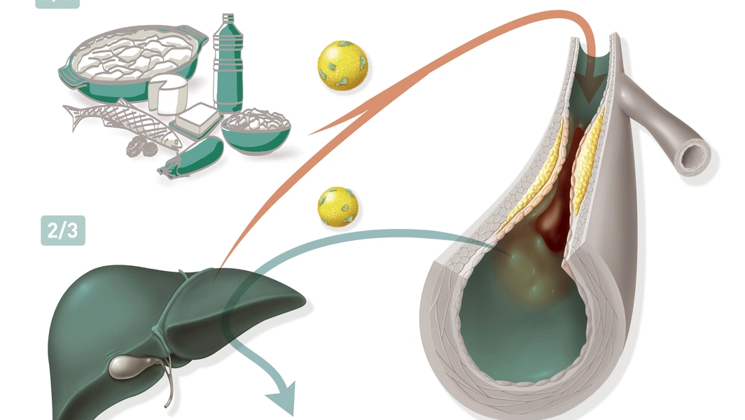 Natural strategies to improve cholesterol levels