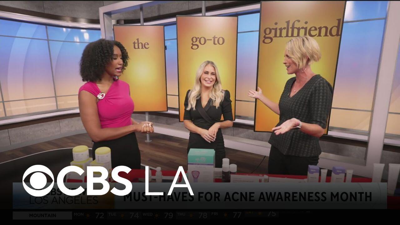 Must-haves for acne awareness month | Go-To Girlfriend