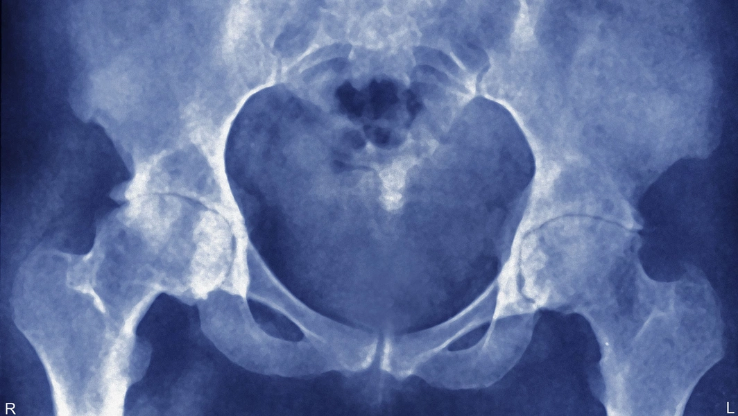 9 indicators of hip health and potential joint damage