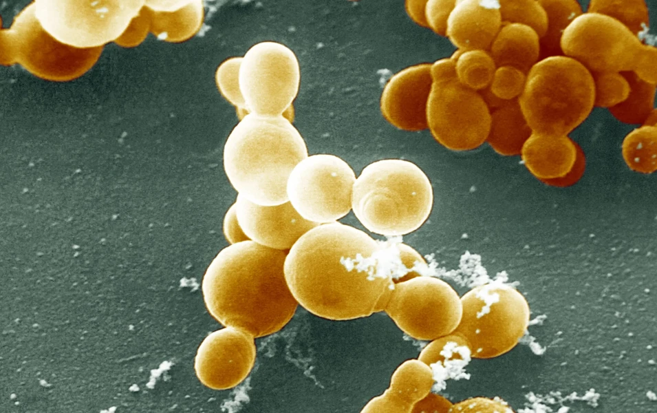 Why your skin spots keep coming back
