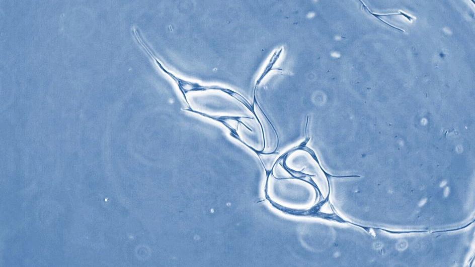 Botulism risks hiding in your kitchen