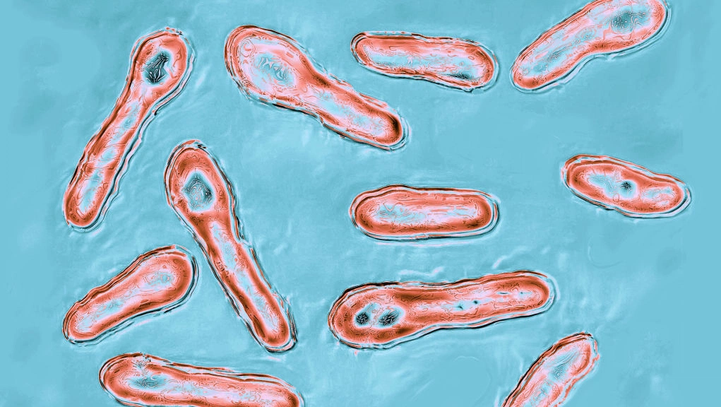 Botulism risks hiding in your kitchen