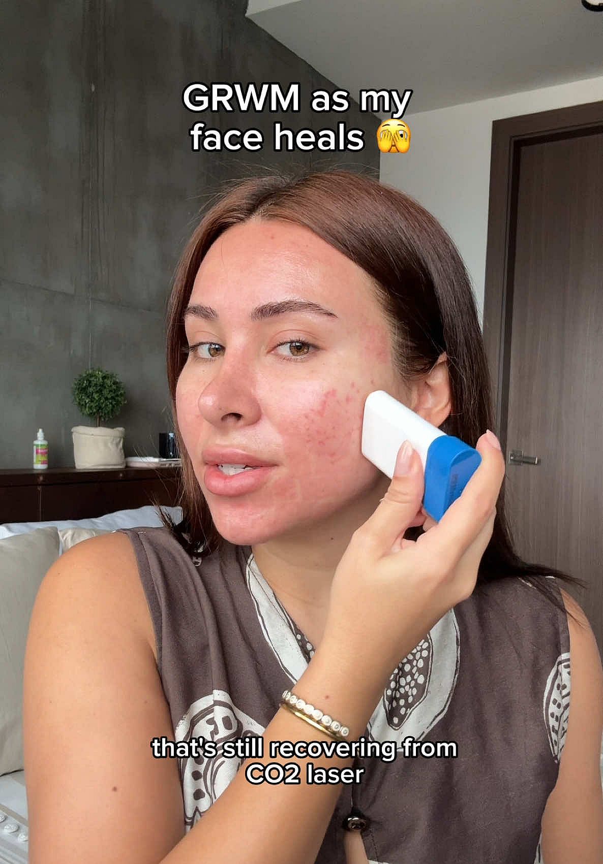 Getting ready while healing from CO2 laser treatment