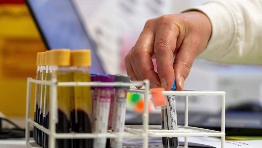7 essential blood tests for older adults
