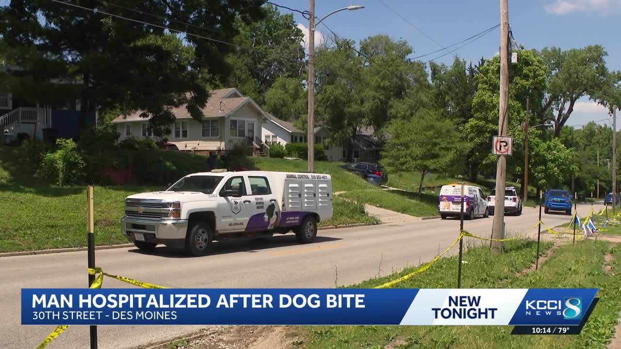 Des Moines man hospitalized after dog attack