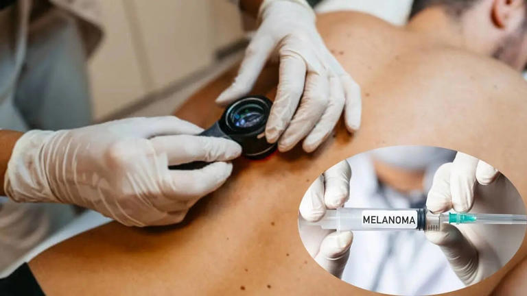 Hope against skin cancer: Personalized vaccine keeps melanoma from ...