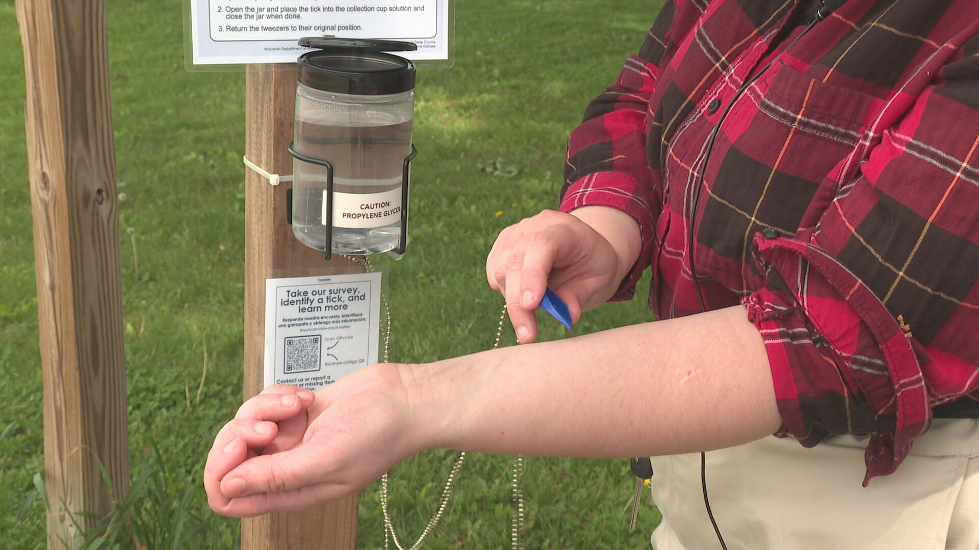 Dane County launches tick check stations as urgent care visits spike