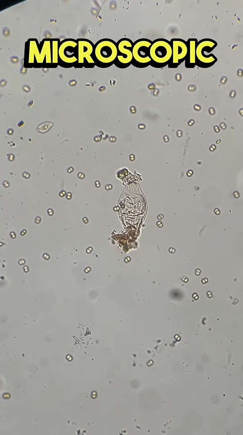 Examining a hand sanitizer dupe under the microscope
