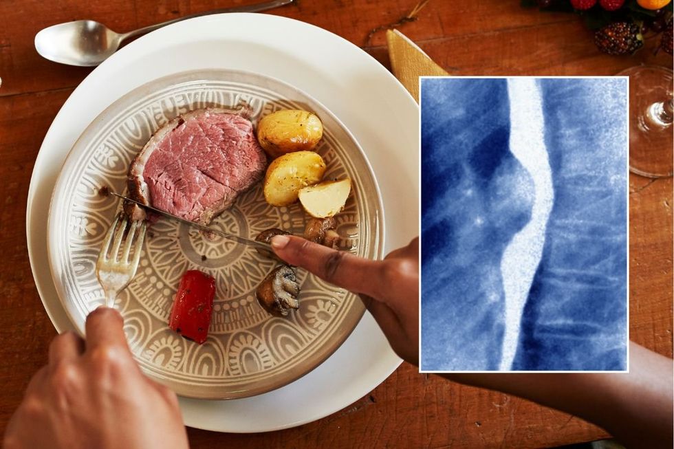 Scientists warn of meat choice linked to 20% higher risk of stomach ...