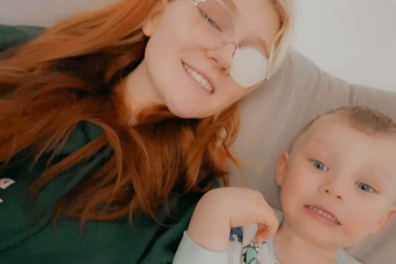 Devoted mum, 24, suffers horror injuries after Nottinghamshire car crash