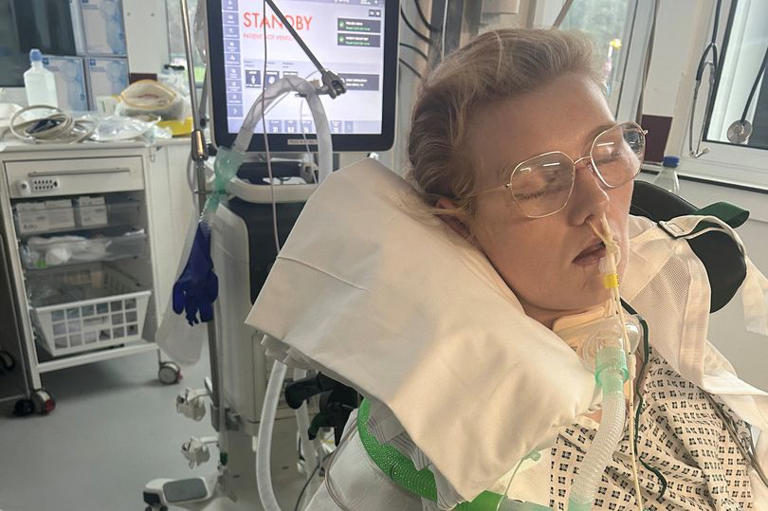 Devoted mum, 24, suffers horror injuries after Nottinghamshire car crash