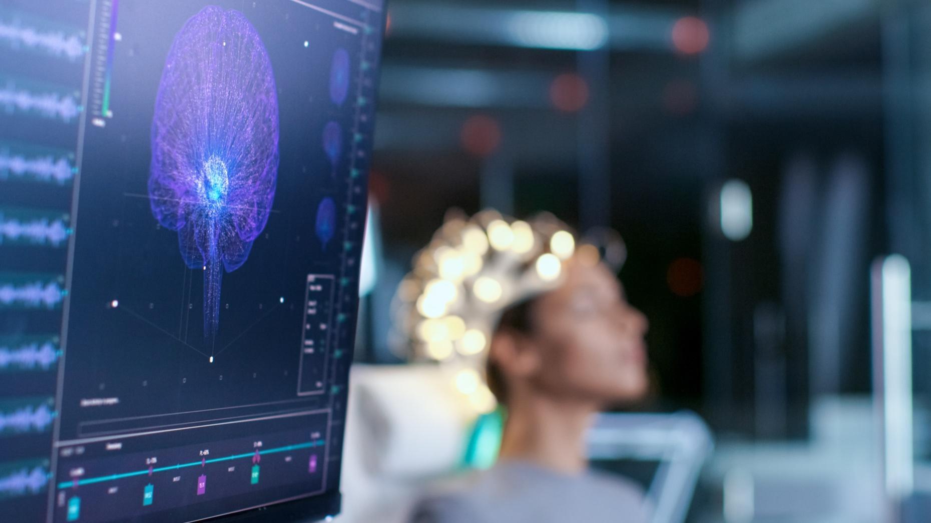 Are screens affecting gen Z’s intelligence? A neurologist explains