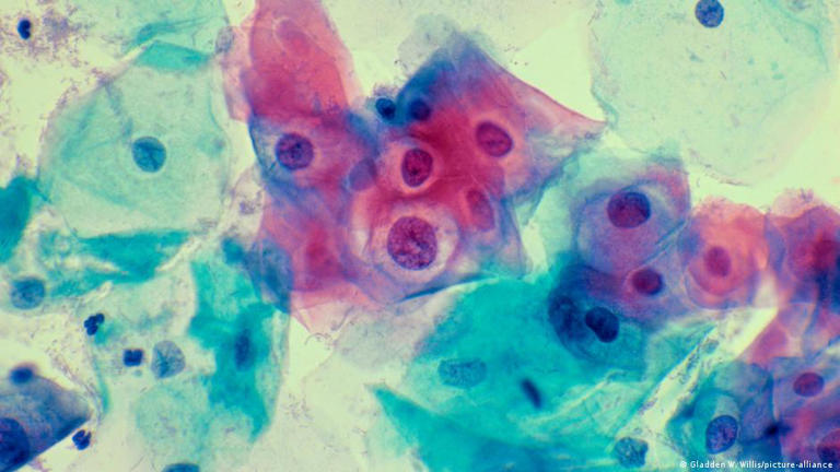 Can the US achieve cervical cancer herd immunity?