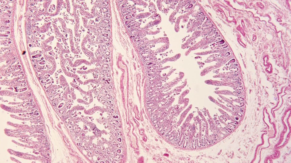 Small habits that heal your gut