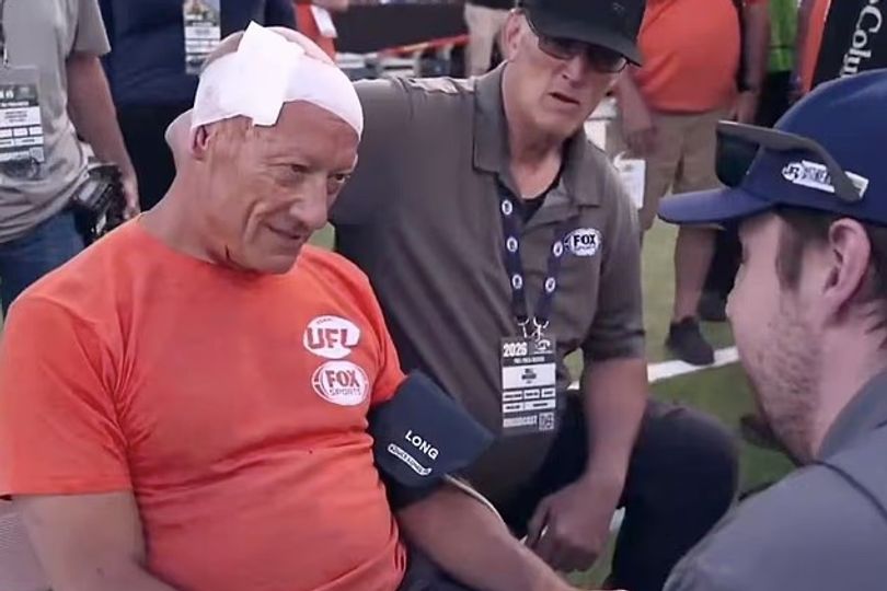 FOX cameraman left bleeding from head after nasty sideline collision ...
