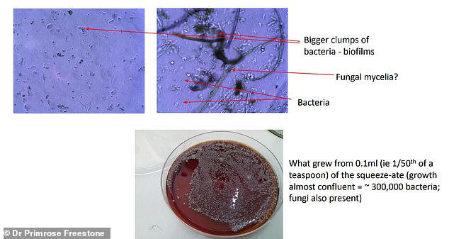 Your kitchen sponge can release millions of dangerous microplastics ...