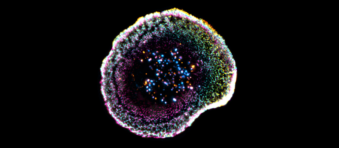 🎯 A never-before-seen view of our killer cells in action