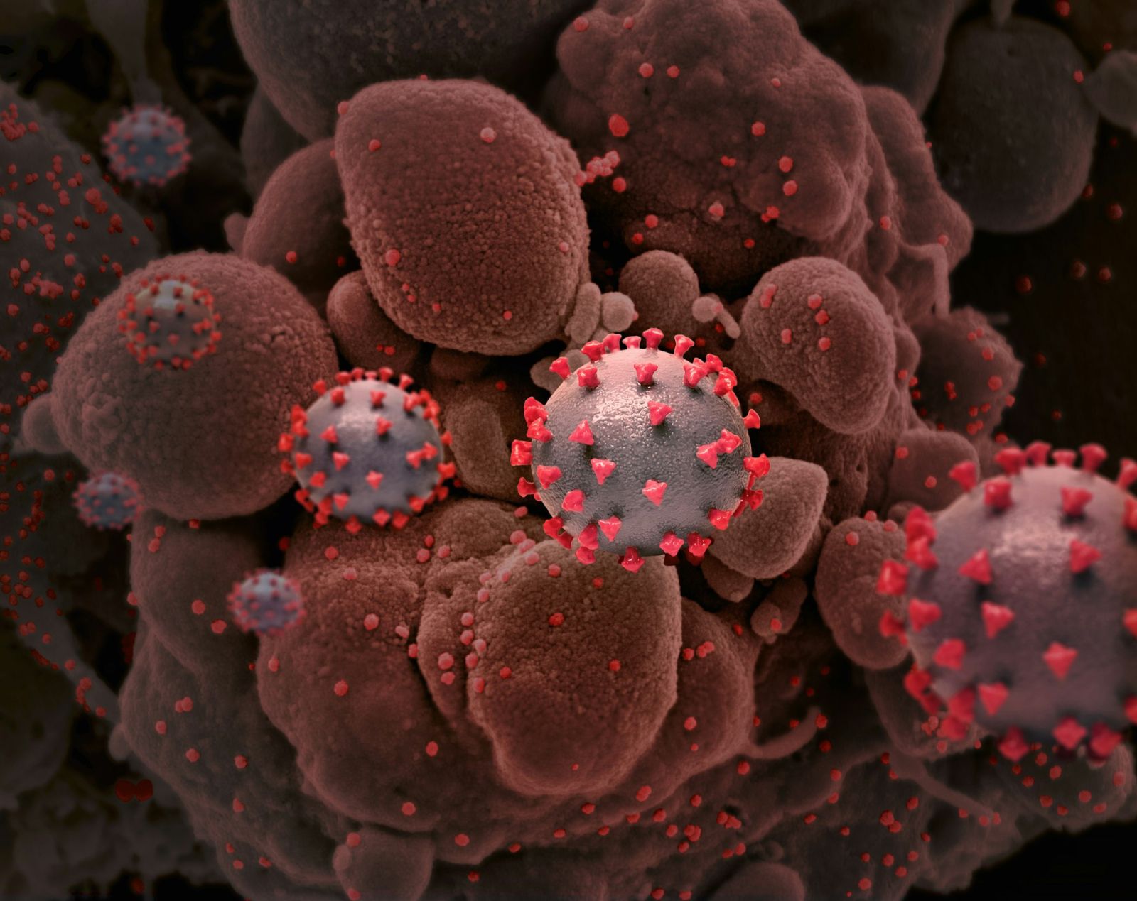 🦠 Some serious viral infections explained by an abnormality