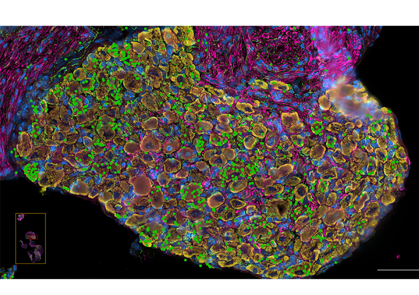 🩺 Itching and skin inflammation: The surprising involvement of our neurons