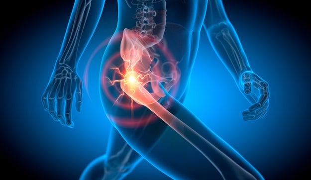 This hip surgeon has 1 great piece of advice for what to do about hip pain