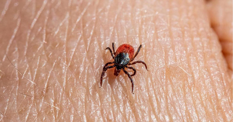 What is alpha-gal syndrome? Man shares severe red meat allergic ...