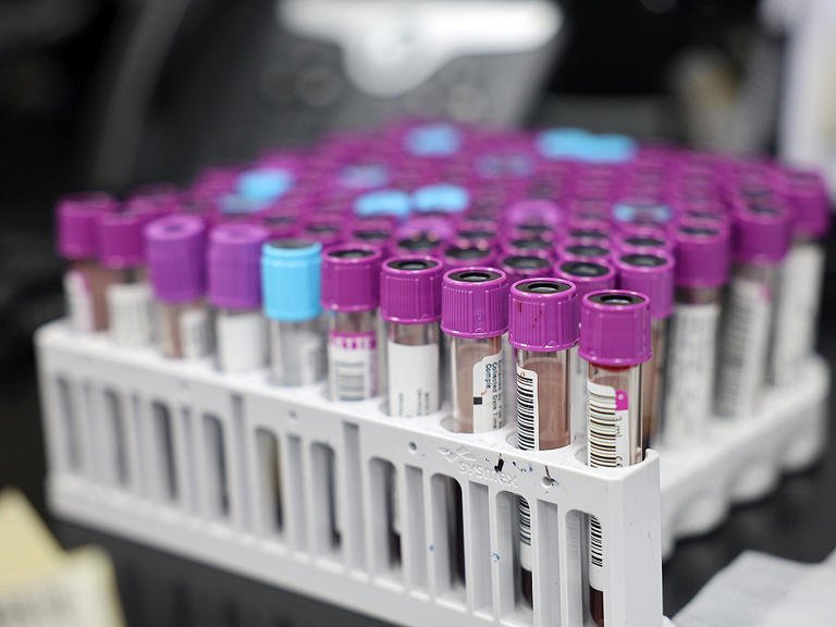 Yas Clinic launches advanced diagnostic laboratory in Abu Dhabi