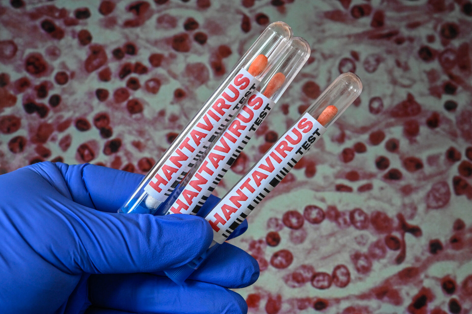 Alert in the US: 'Super El Niño' could cause a rise in hantavirus cases ...