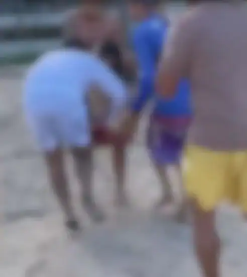 Mulher tem a perna devorada por tubarão em praia de Recife