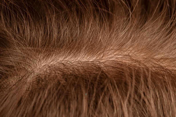 Why healthy hair starts at the root and why scalp health matters more ...
