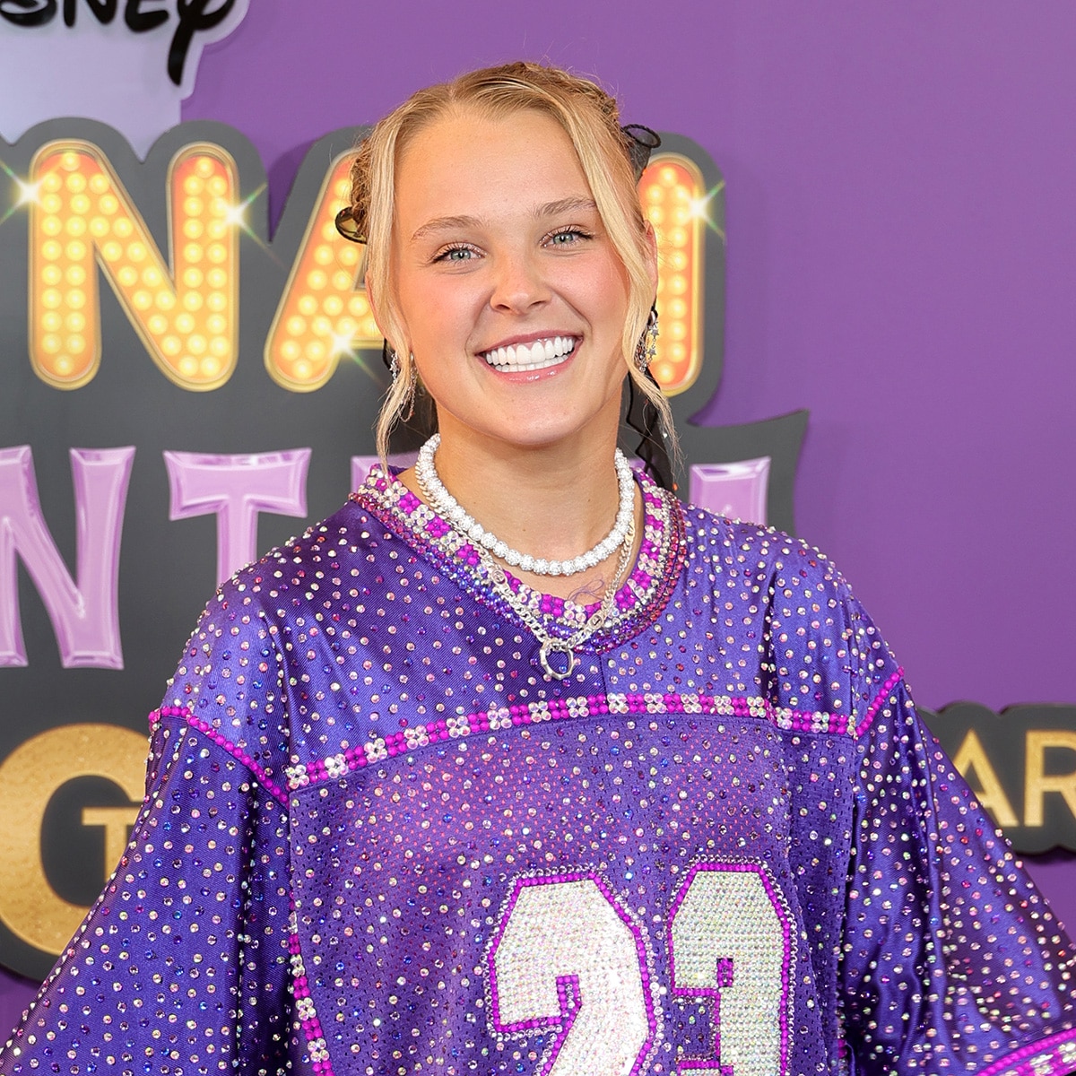 JoJo Siwa details suffering from 'gnarly' eye infection and concussion
