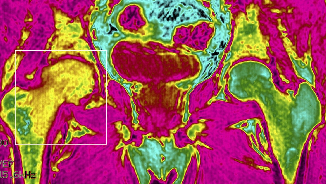 16 exercises to avoid for bone health after 60