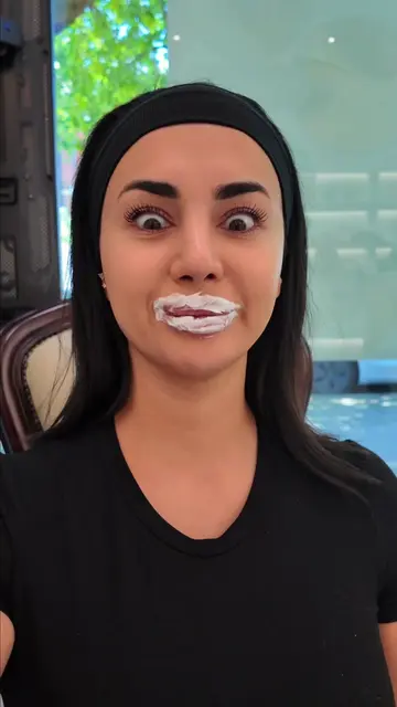I finally topped up my lips and botox after 3 years