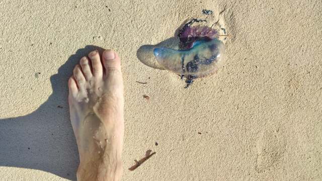 Myrtle Beach officials warn venomous man o' war can deliver painful ...