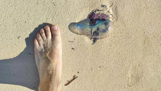 Myrtle Beach officials warn venomous man o' war can deliver painful ...