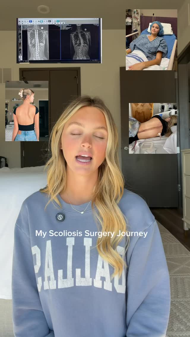 Scoliosis surgery journey and recovery update
