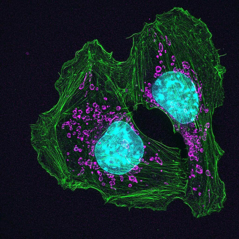Smaller cancer cells may be more dangerous than we thought