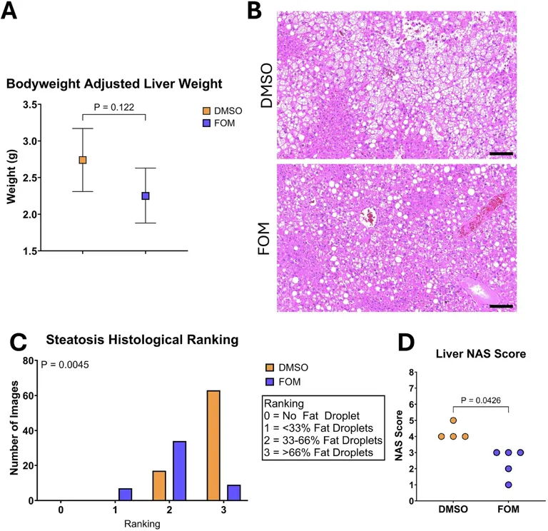 Common asthma drug may reverse dangerous fatty liver disease