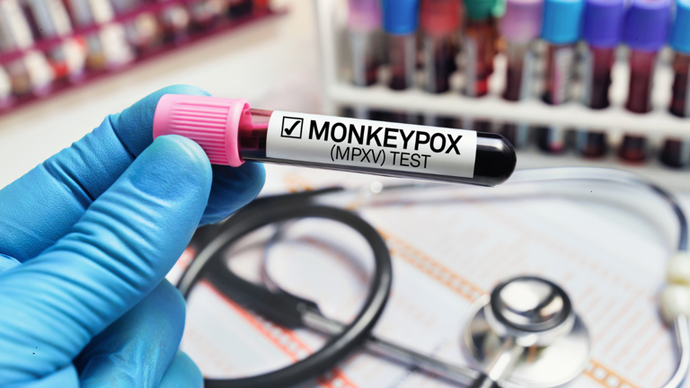 Western Australia records 22 MPOX infections in 2026; seven reported ...