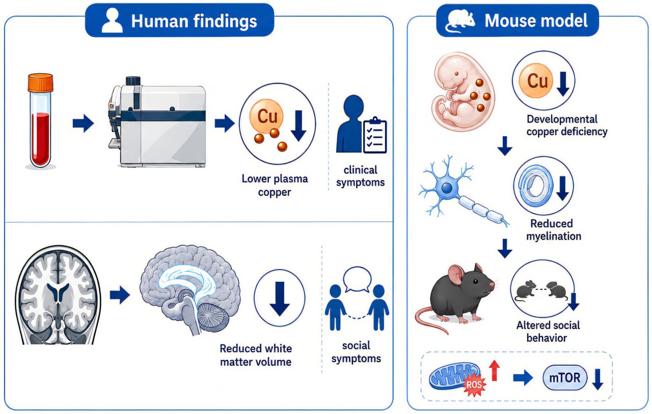 Copper imbalance tied to autism's social symptoms and white matter ...