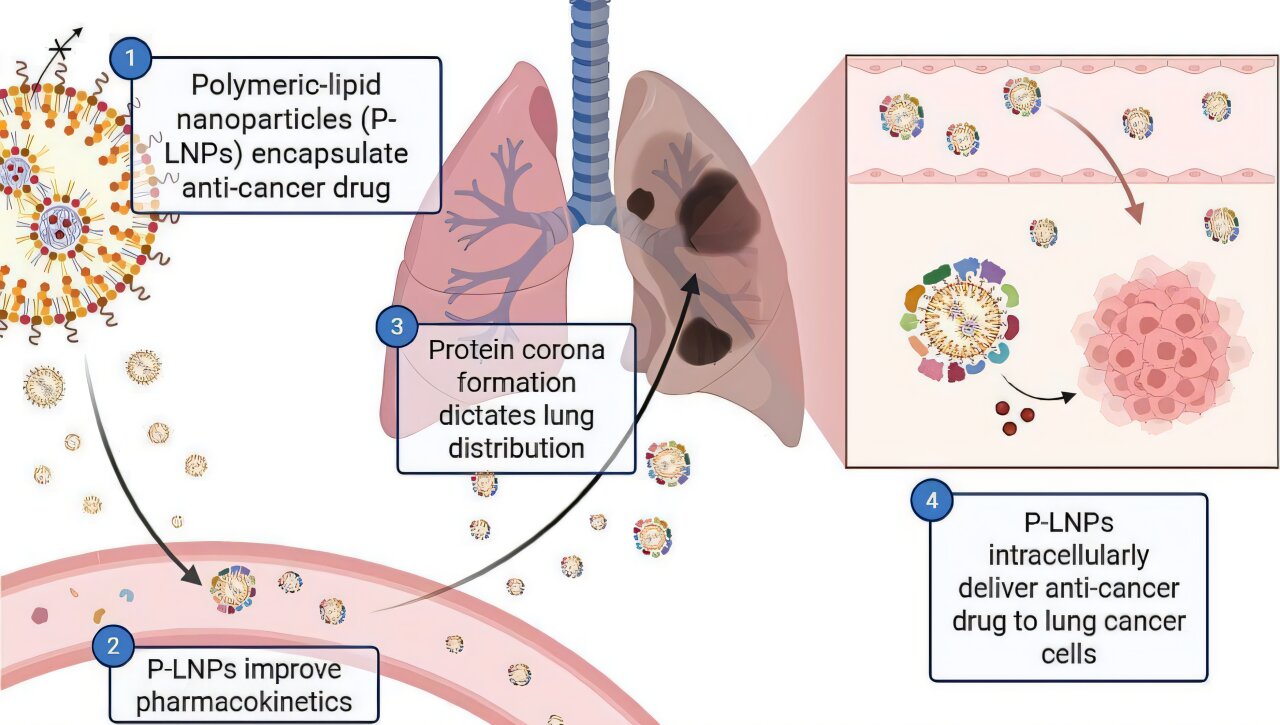 Nanoparticles boost delivery of lung cancer drugs 30-fold