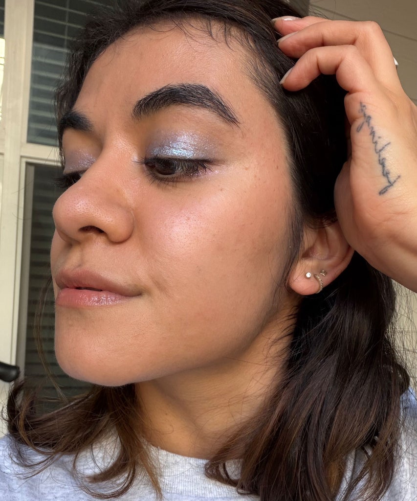 I thought my hyperpigmentation was acne scarring — until a ...