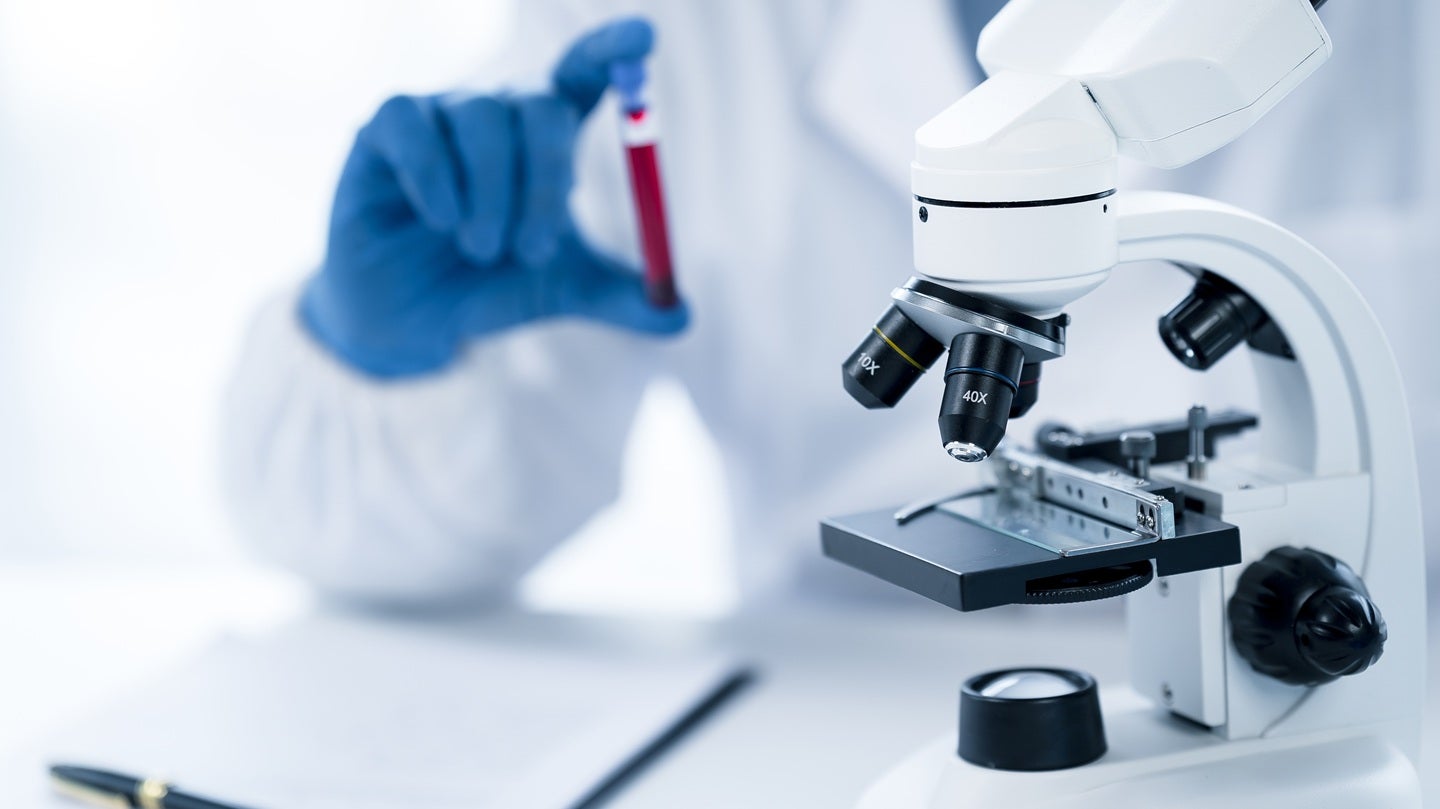 Abivax’s obefazimod met primary endpoint in Phase III ABTECT trial