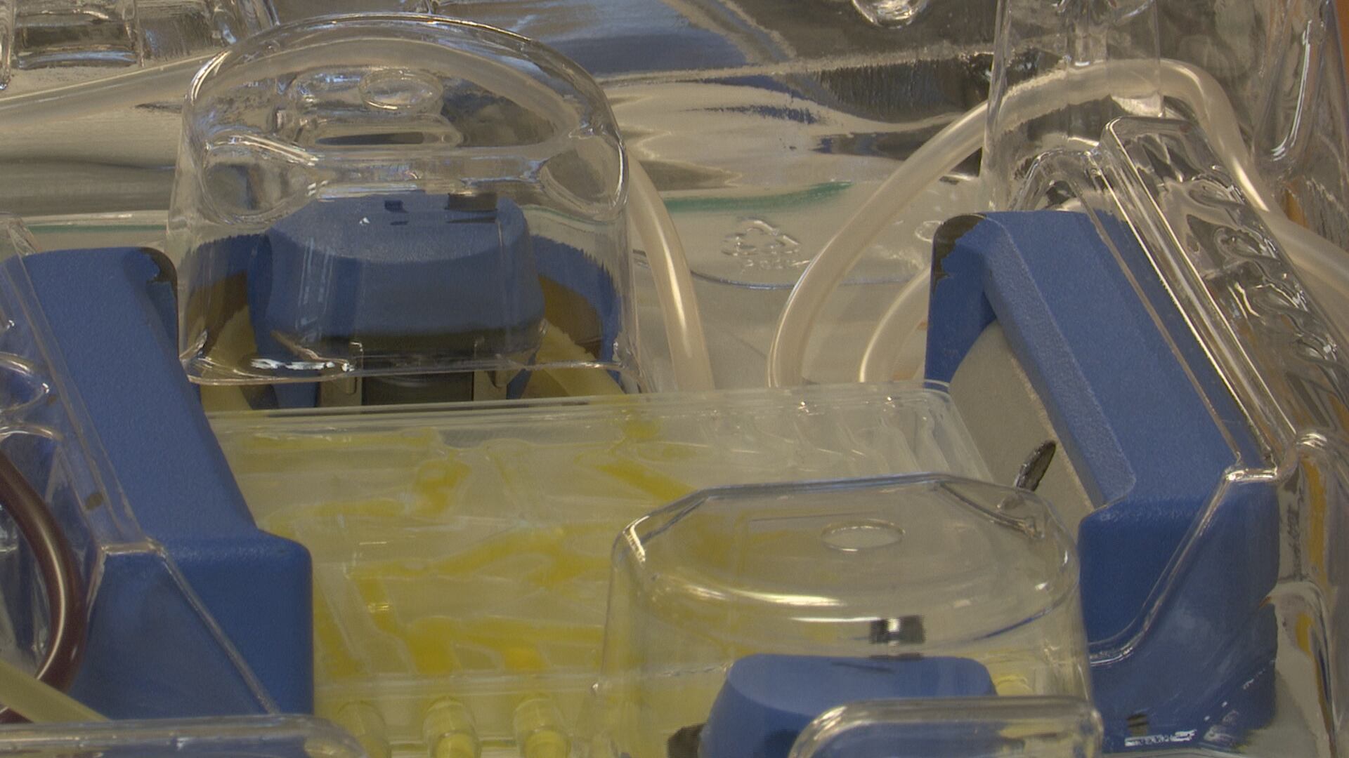 Red Cross issues urgent call for blood donations as summer supply drops