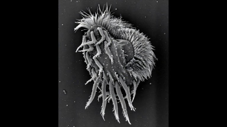 Single cell transforms into cannibalistic 'supergiant,' swallowing its ...