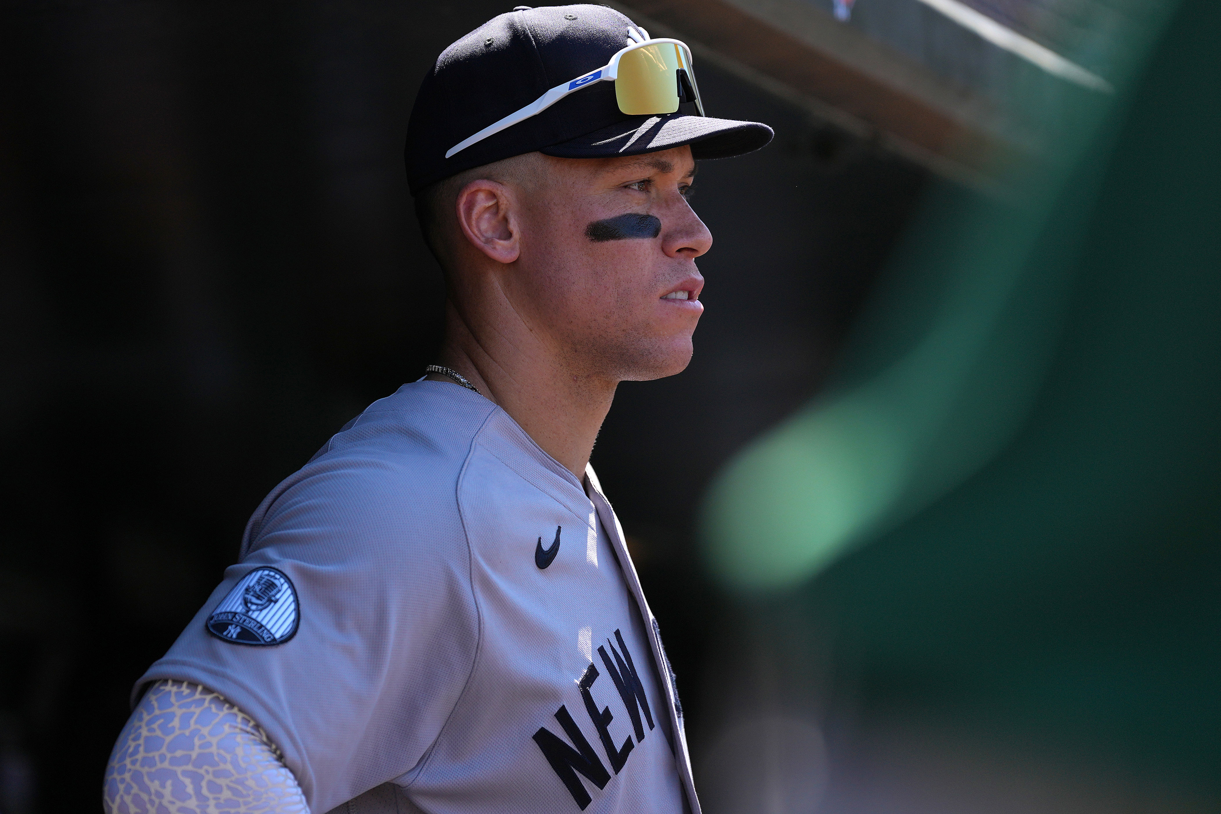 Yankees star Aaron Judge has bone bruise, will meet with doctor Tuesday ...