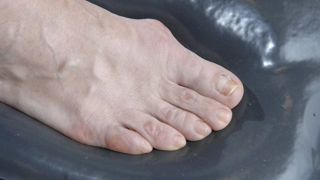 Orthopedic sandals merge health benefits with summer style trends