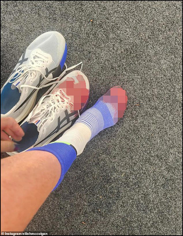 Eilish McColgan wearing a 'moon boot' after painful London Marathon injury