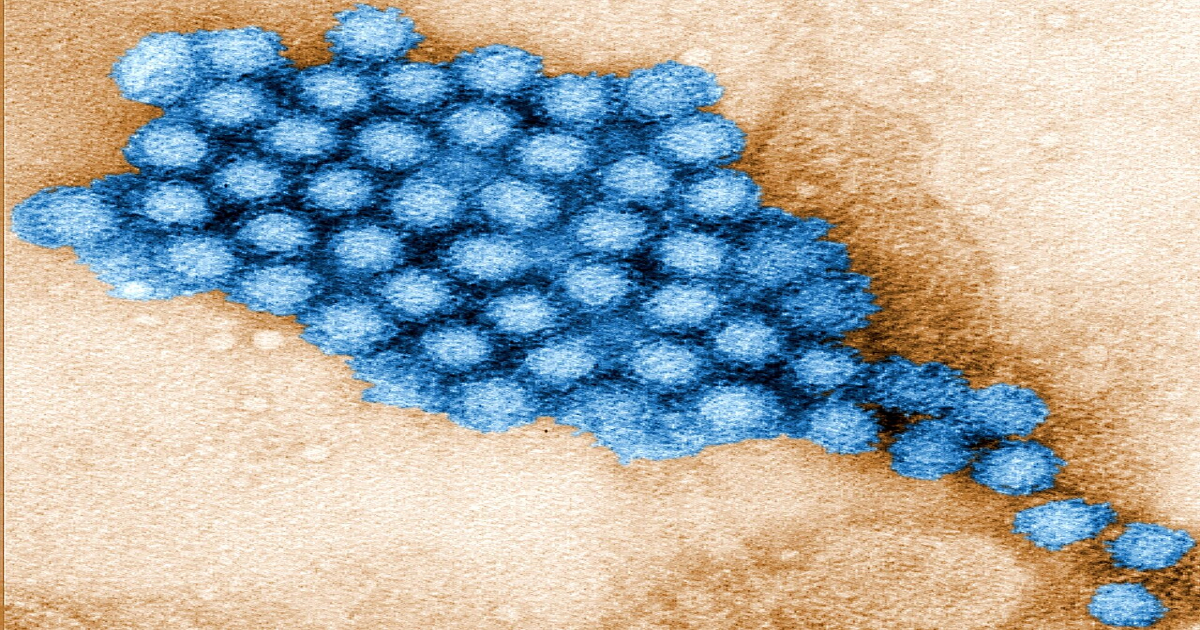 Is a 'vomiting virus' sweeping the US? New data reveals sharp rise in ...